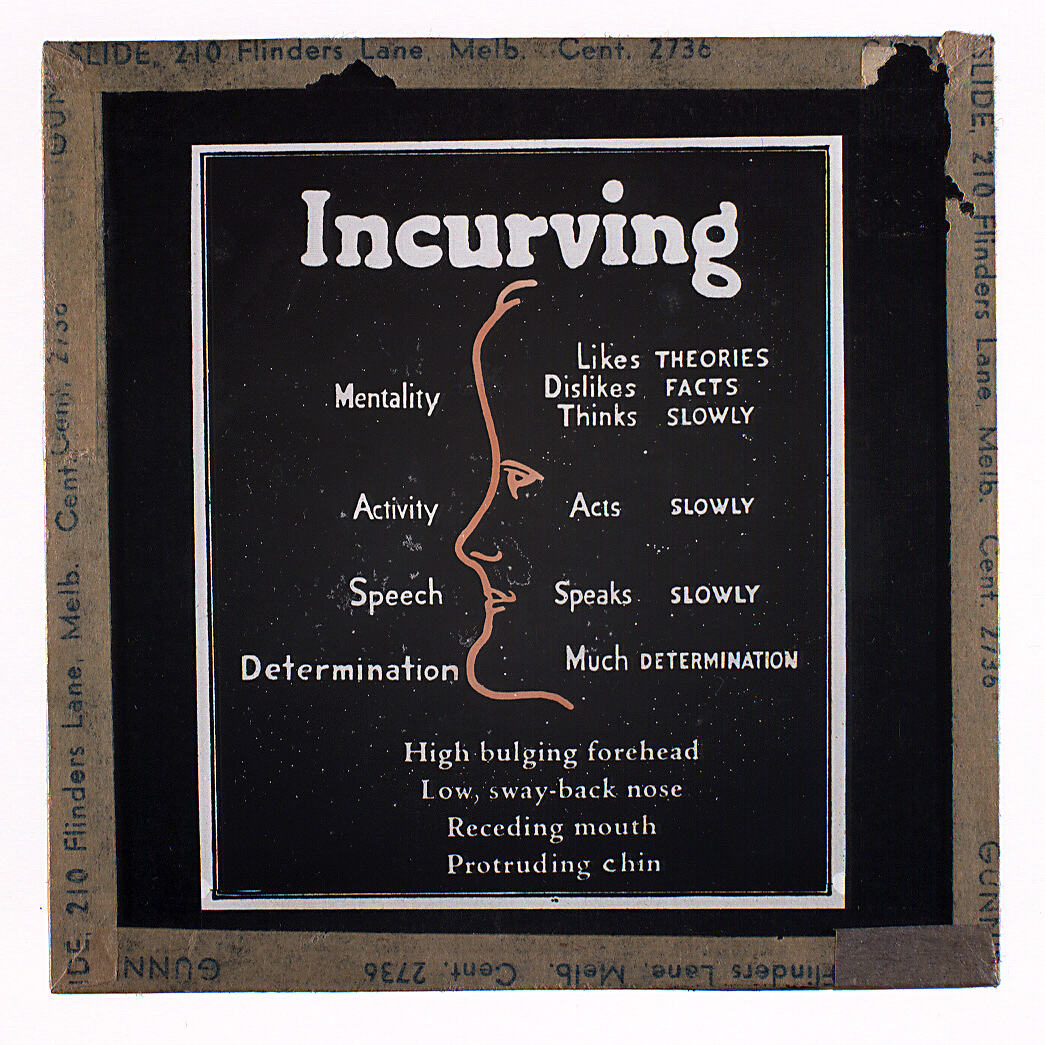 Lantern Slide - Facial Profile & Personality, 'Incurving', circa 1940s