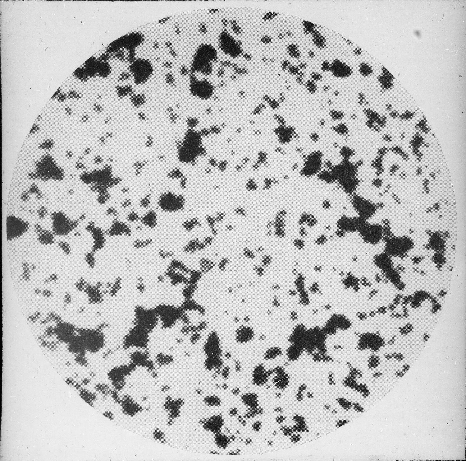 Lantern Slide - Microscopic View of Emulsion Grains, History of ...
